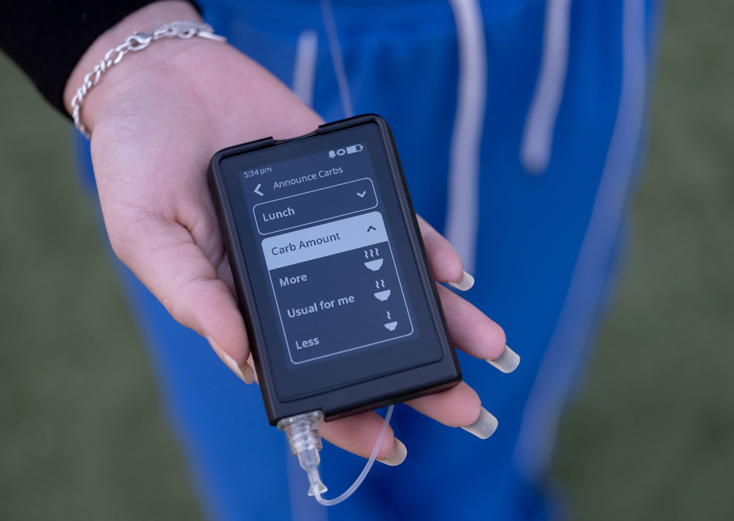 'Bionic pancreas' tested locally adapts to diabetes patient needs